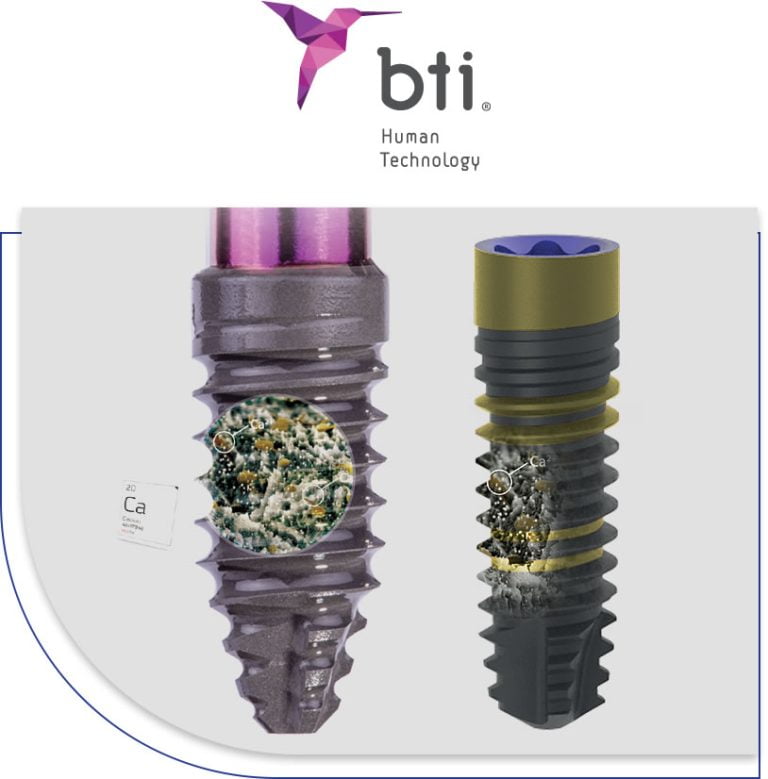BTI's Implants & Abutments - Dental Supplies - Synca