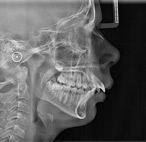 I-MAX PRO Pan/Ceph/3D Machines - Dental Supplies - Synca