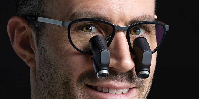 KEPLER REFLEKT - Dental Supplies - Synca