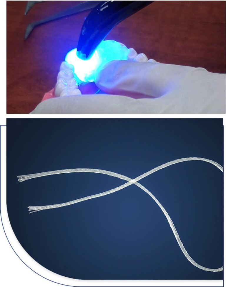 FAST SPLINT MATRIX® - Dental Supplies - Synca