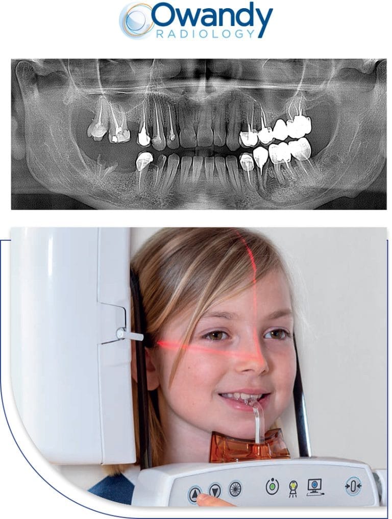 I-MAX PRO Pan/Ceph/3D Machines - Dental Supplies - Synca