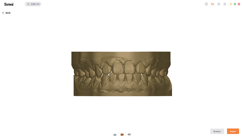 SOREAL - Dental Supplies - Synca